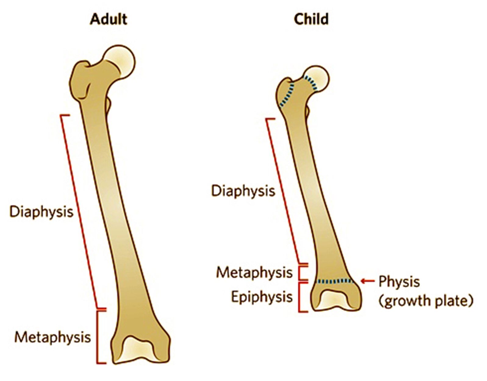 How are Children’s Bones different from Adult’s Bones? - Young Bones Clinic